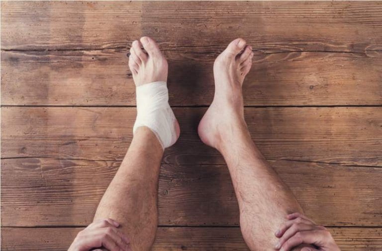 Don’t Just Walk it Off: Dealing with a Broken Foot – Keep Healthy Living