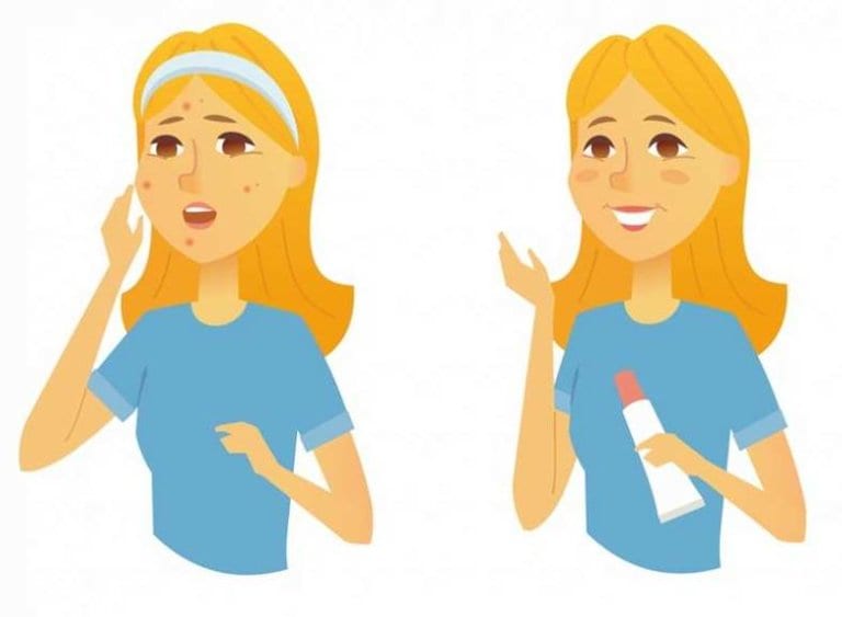 Skin tags – What causes them and how to remove them – Keep Healthy Living