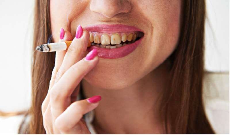 8 Tips How to Protect My Teeth While Smoking – Keep Healthy Living